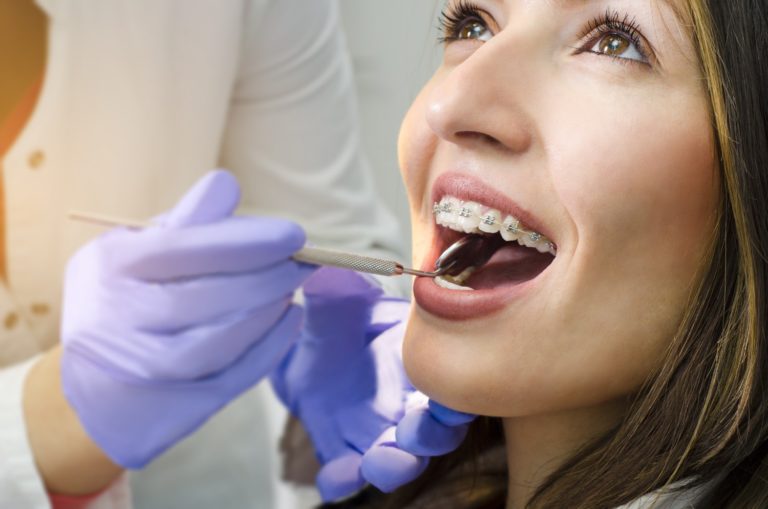 What to Do if You Have a Loose Bracket on Your Braces | Frey Ortho